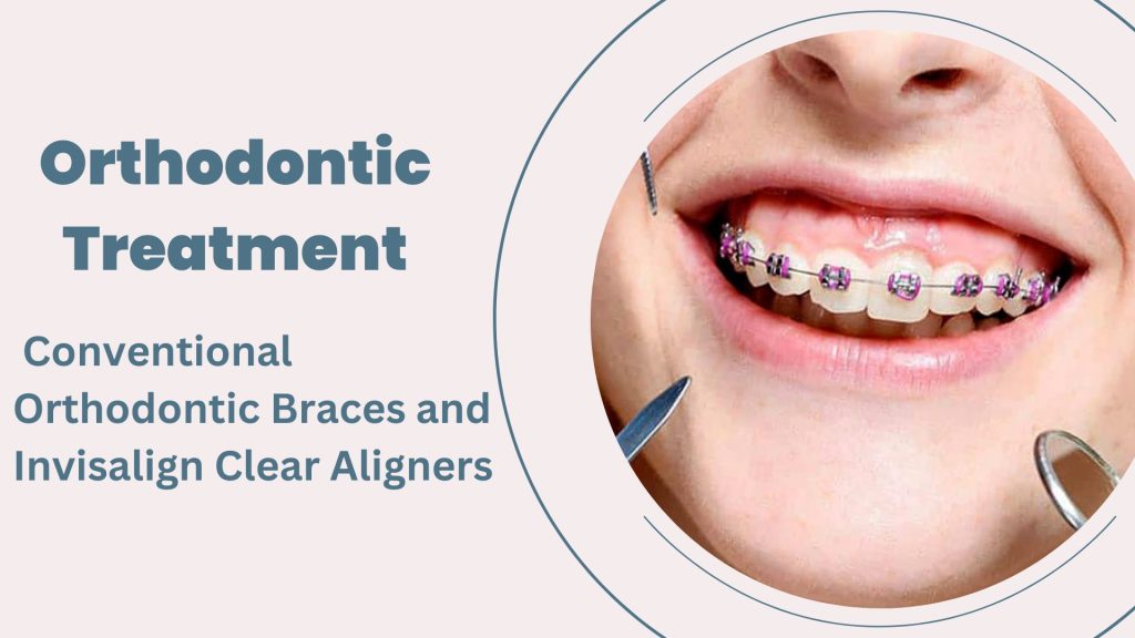 Orthodontic treatment:- Conventional Orthodontic Braces and Invisalign ...