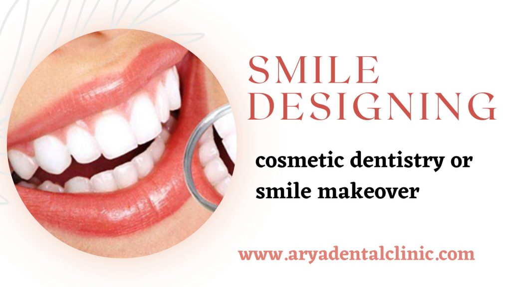 Smile designing:- cosmetic dentistry or smile makeover – Arya Dental Clinic